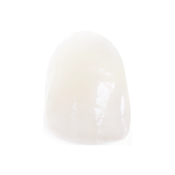 Couronnes et bridges | MM Dental – Laboratoire Dentaire