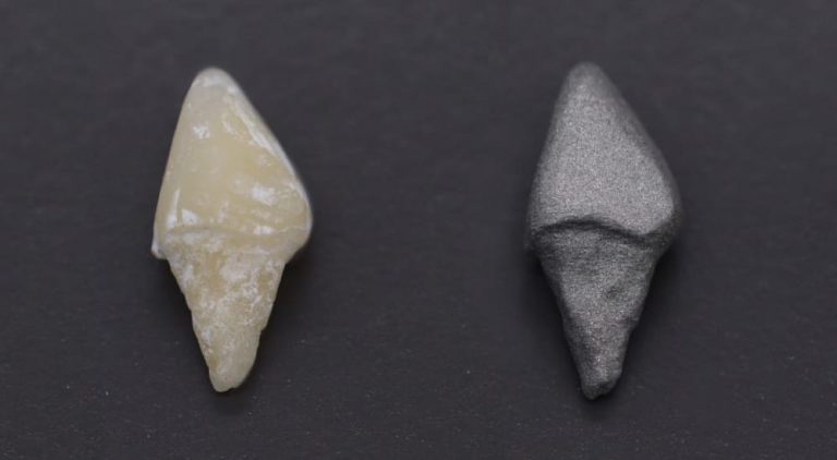 La confection d’un faux moignon en combinant la méthode traditionnelle ...